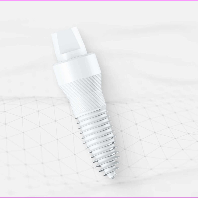 Holistic Health Dental Care | Ceramic Dental Implants