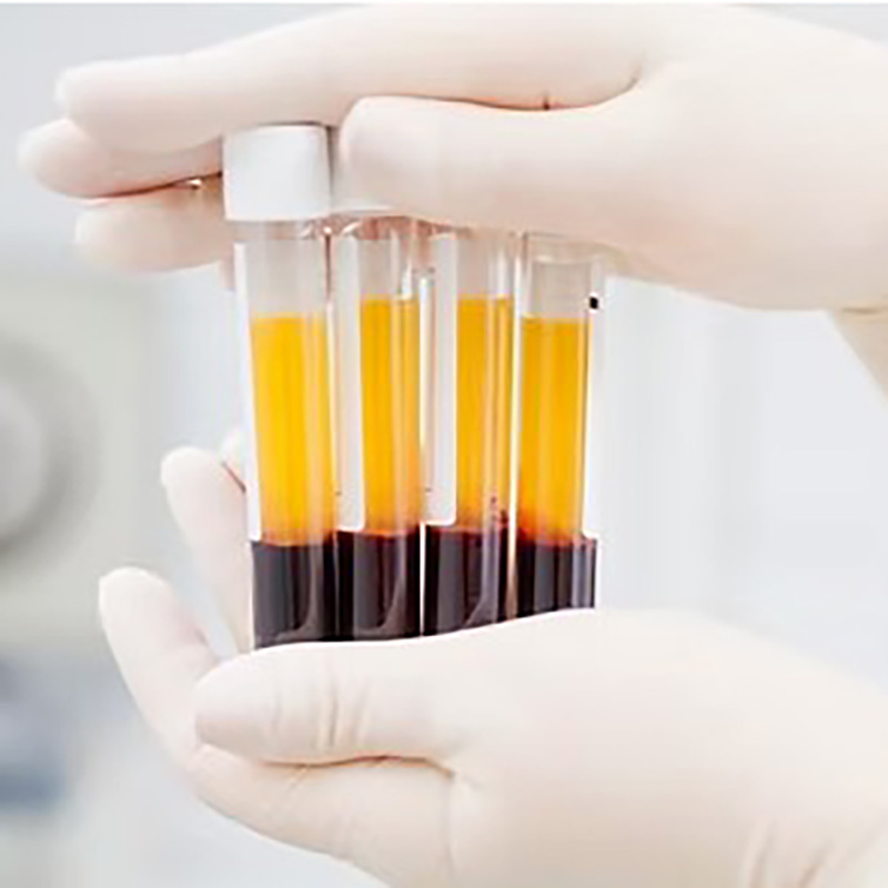 Holistic Health Dental Care | Ceramic Dental Implants